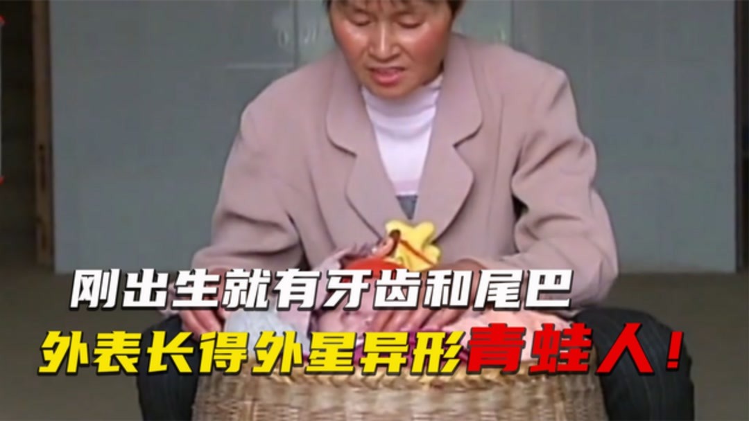 婴儿刚出生就有牙齿和尾巴,长相犹如异形,把医生都吓着了