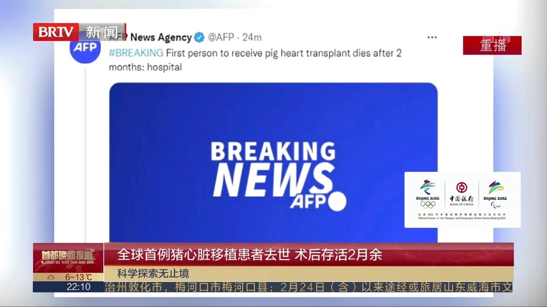 全球首例猪心脏移植患者去世 术后存活2月余