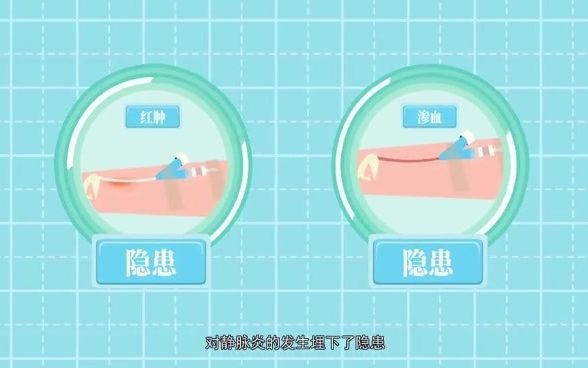 医药宣传典型MG宣传需要客户提供文案脚本即可