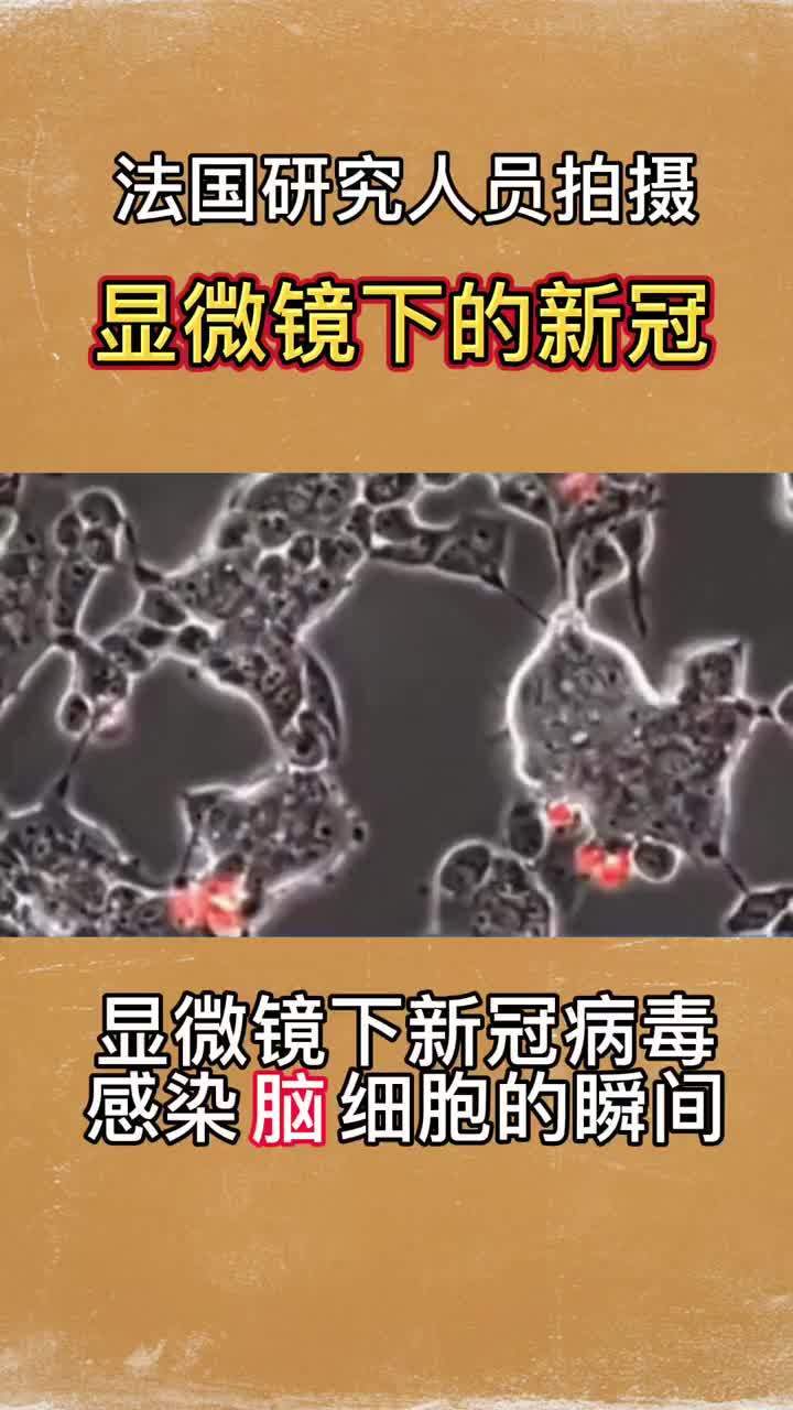 显微镜下的世界此素材来源网络如有侵联系删