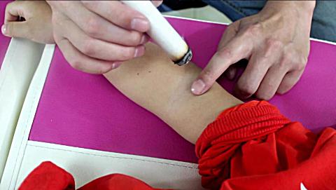 向大家分享针对小孩久咳不愈的艾灸辅助方法, 灸两个地方作用不错