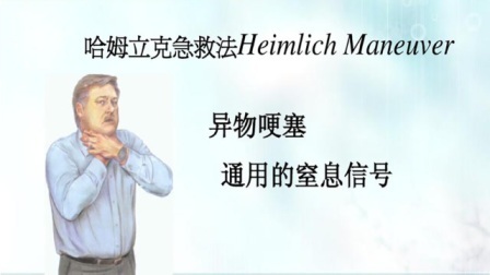 食管气管进异物?医生:拍背易造成更大伤害,用哈姆力克法!