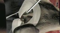 膝关节半月板修复手术,3D动画模拟全过程,简单明了