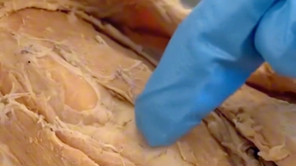 #医学解剖#大体老师#尸变图鉴