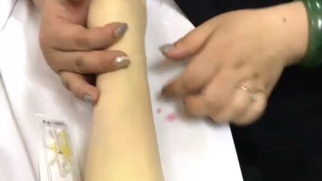 静脉留置针操作步骤及相关注意事项