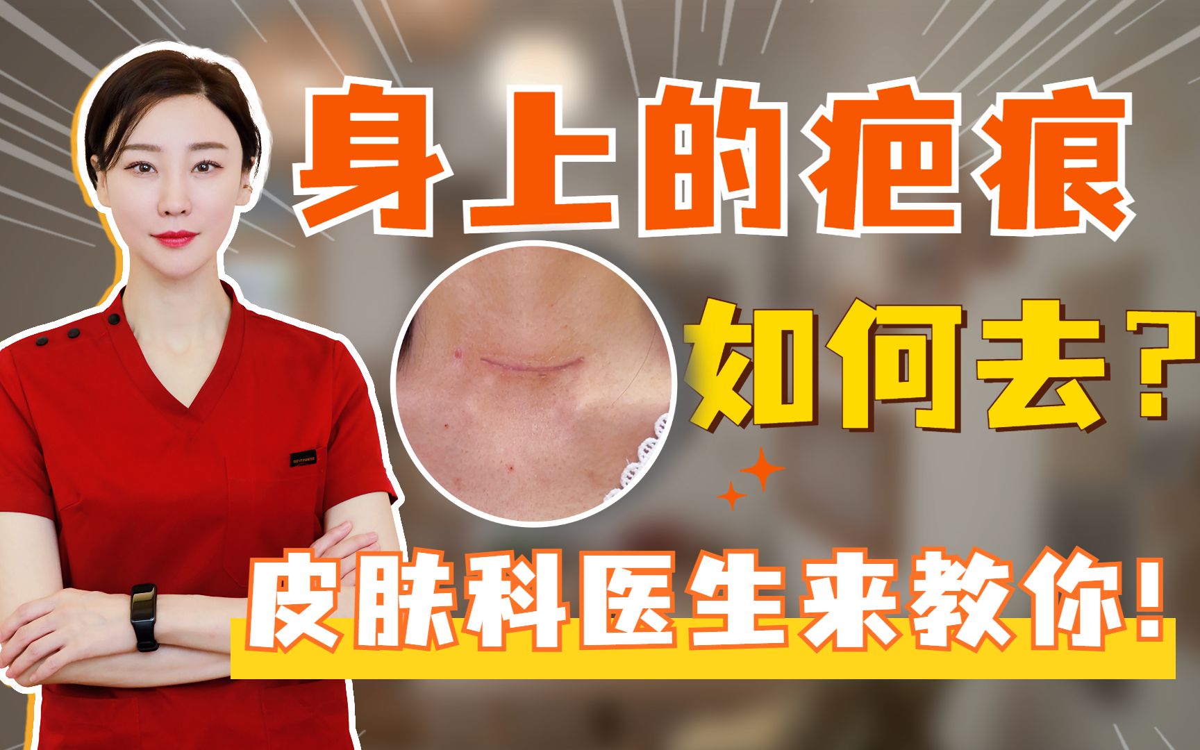 身上的疤痕如何去?皮肤科医生告诉你!