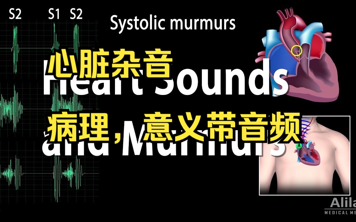 【油管】 心脏杂音病理,意义,病因 带音频