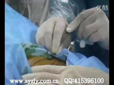 ...靶点治疗椎间盘突出症的安全性 。臭氧治疗 臭氧治疗法 臭氧治疗仪 ...