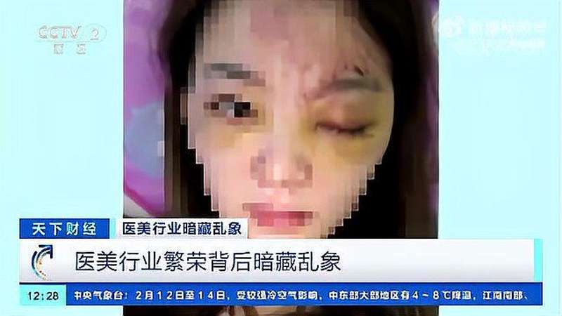 ...结果注射到血管里面去了,造成中央动脉堵塞,小雪被紧急送往医院抢救...