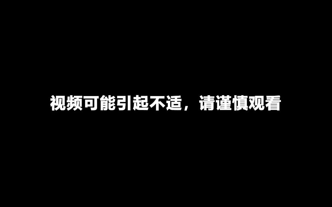 哥伦比亚一名女子被自己的狗攻击 爬进电梯寻求帮助