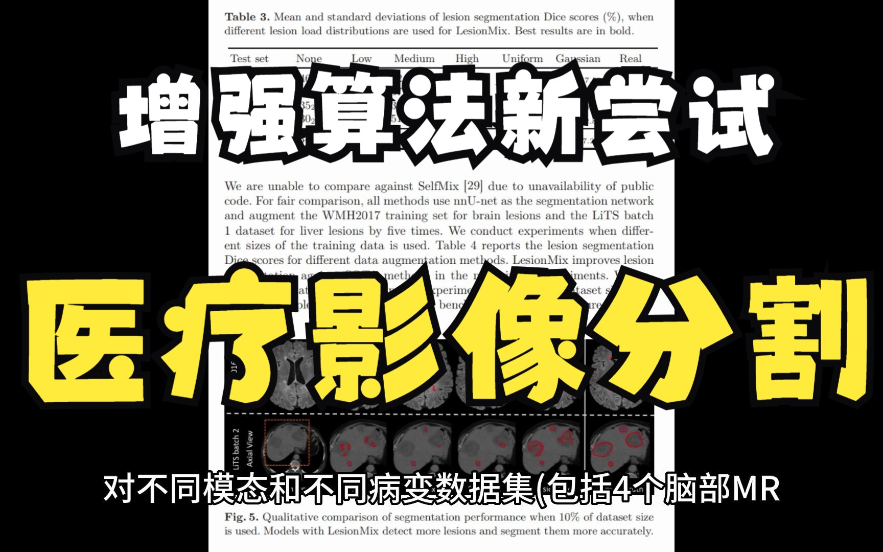 医疗影像数据不够怎么办---医疗影像分割领域最新数据增强算法打破...