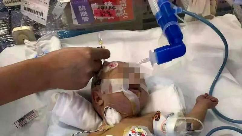 女婴拖条“大尾巴”出生形似“双头人” 吓坏现场人