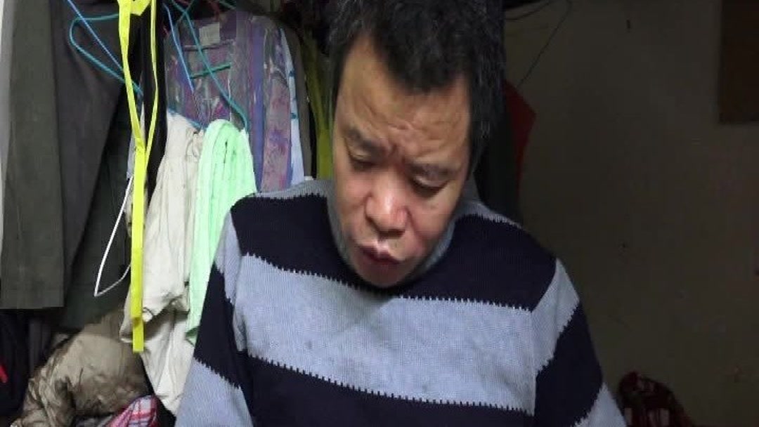 深圳男子手术后,导管体内留二年全