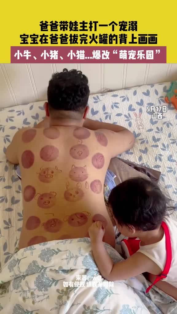 宝宝在爸爸拔完火罐的背上画画,小牛、小猪、小猫,好多小动物