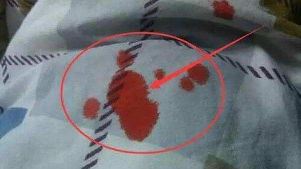 不管床单血渍多顽固,教你不用一滴水,新老血渍全洗净,终生受益