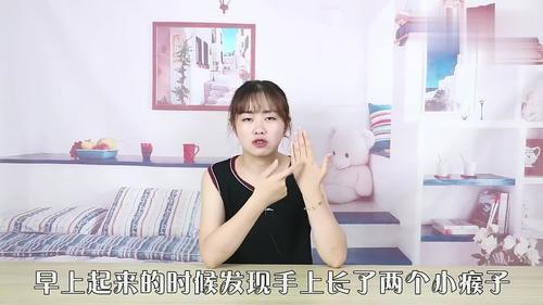 身体长了瘊子太难看?教你3个小方法轻松去除瘊子,快试试吧