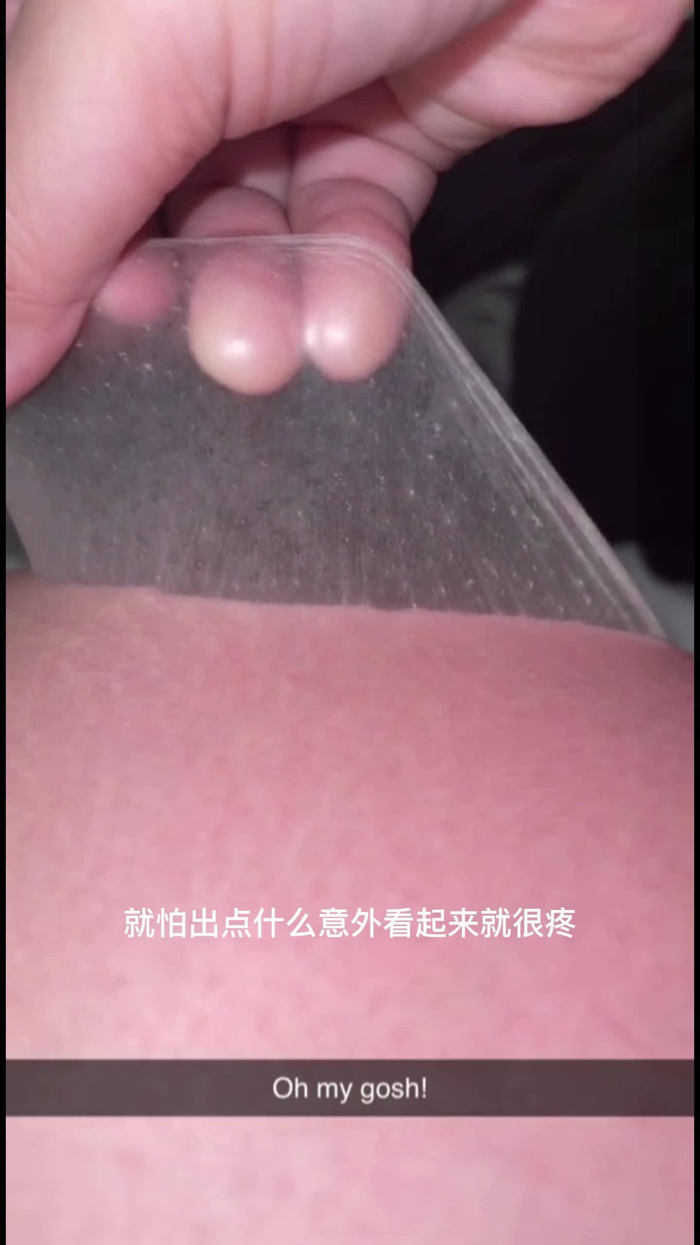 不要随便去撕皮肤上的死皮,就亿点点小疼