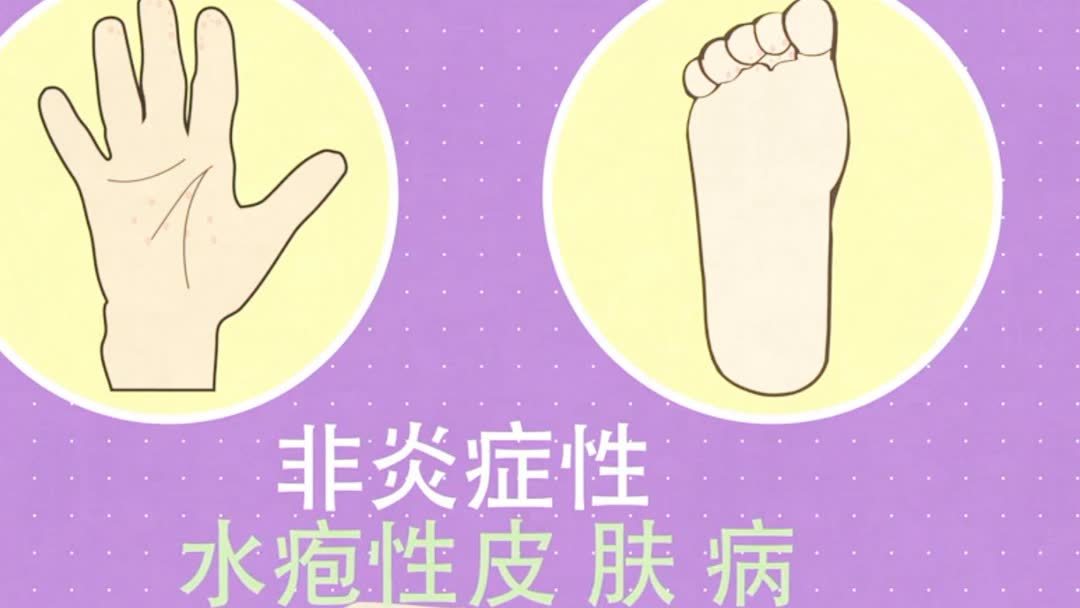 夏季手上脱皮瘙痒多是这种病 专家建议三种用药方法都可治病!