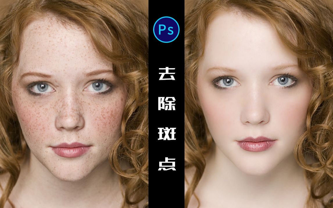 【PS教程】去除雀斑