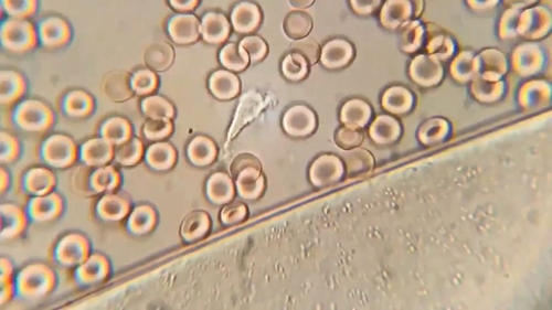 显微镜下白细胞在捕杀微生物