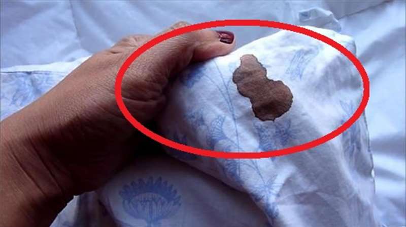 不管床单血渍多顽固,用这个方法,不需一滴水,新老血渍一搓就掉