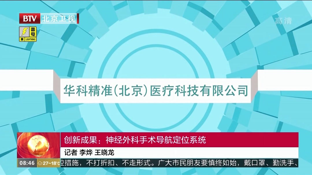 创新成果:神经外科手术导航定位系统