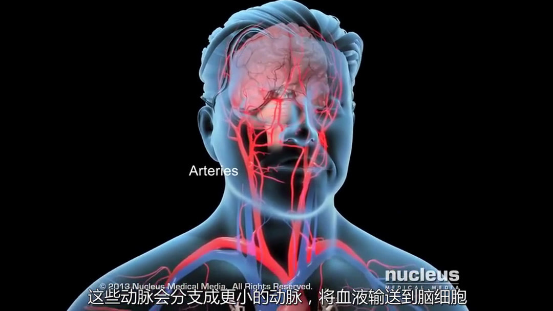 视频颅内动脉瘤
