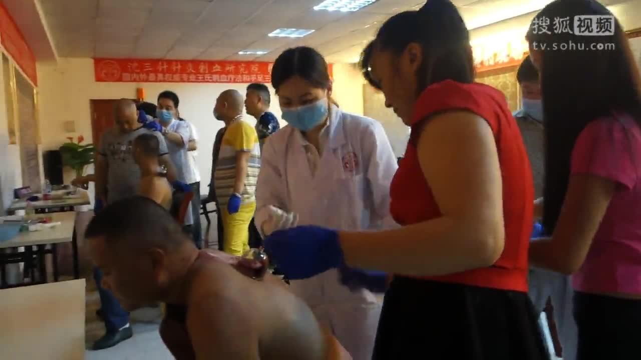 后背刺血拔罐疗法视频