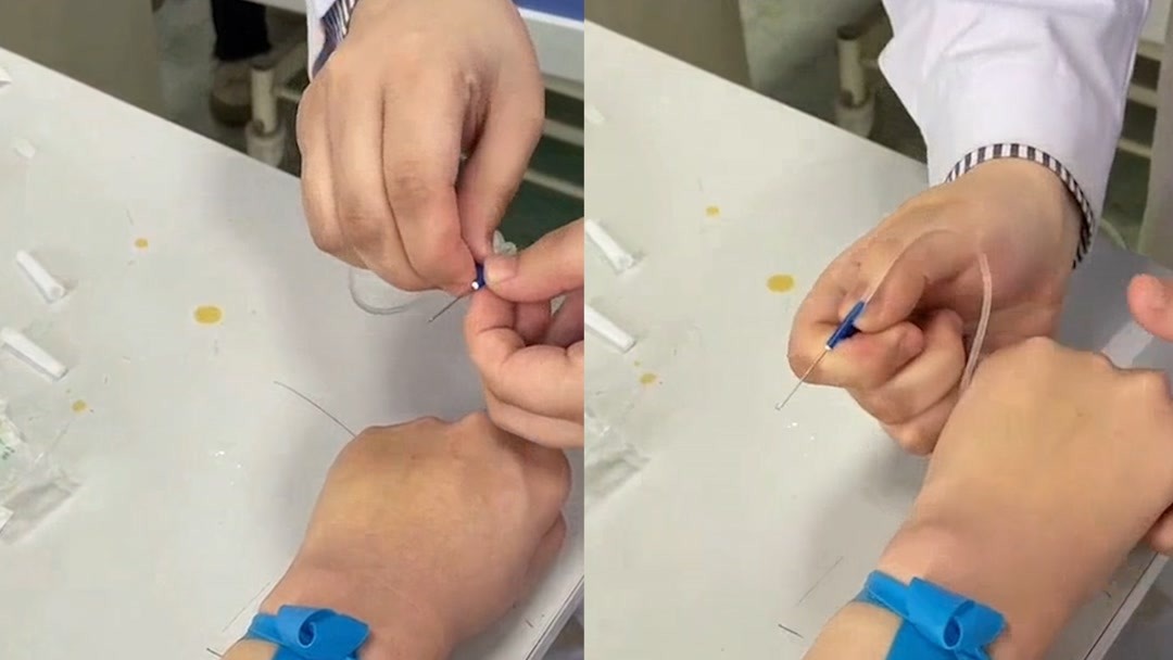 医学生练习扎针,手抖连针都拿不稳,网友看得心惊肉跳:别毕业!