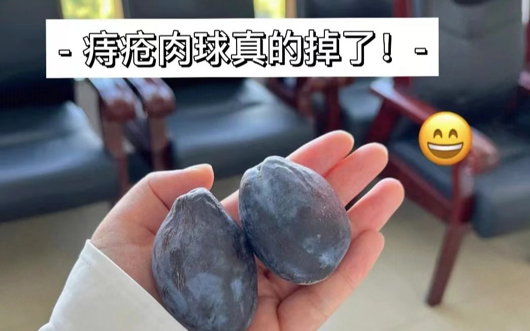 痔疮人进来看!康复者首次分享祛痔全过程,现在知道还不算晚!