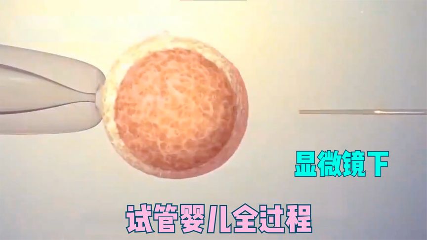 试管婴儿 全过程讲述 感受现代医学的魅力