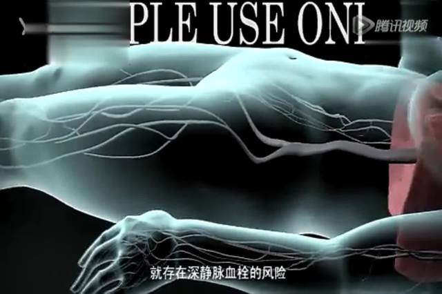 深静脉血栓是如何形成的?#下肢深静脉血栓#静脉血栓的成因