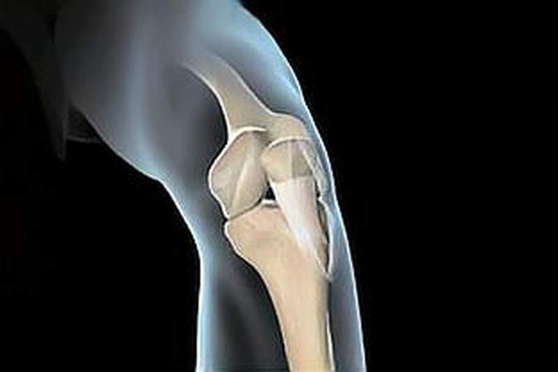 老人骨折该怎么办?骨折后需要注意些什么?