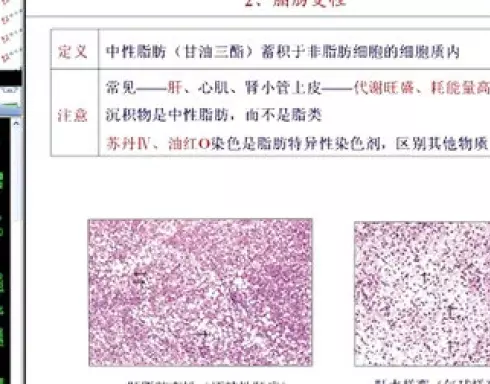 银成医考-病理-第01章细胞组织的适应、损伤与修复01节(51分钟)