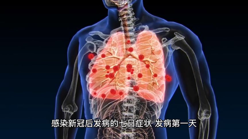 现在感染了新冠会有什么症状你知道吗?