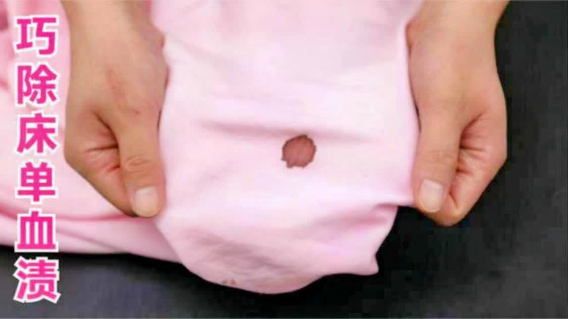 无论床单血渍多顽固,教你清洗诀窍,新老血渍...