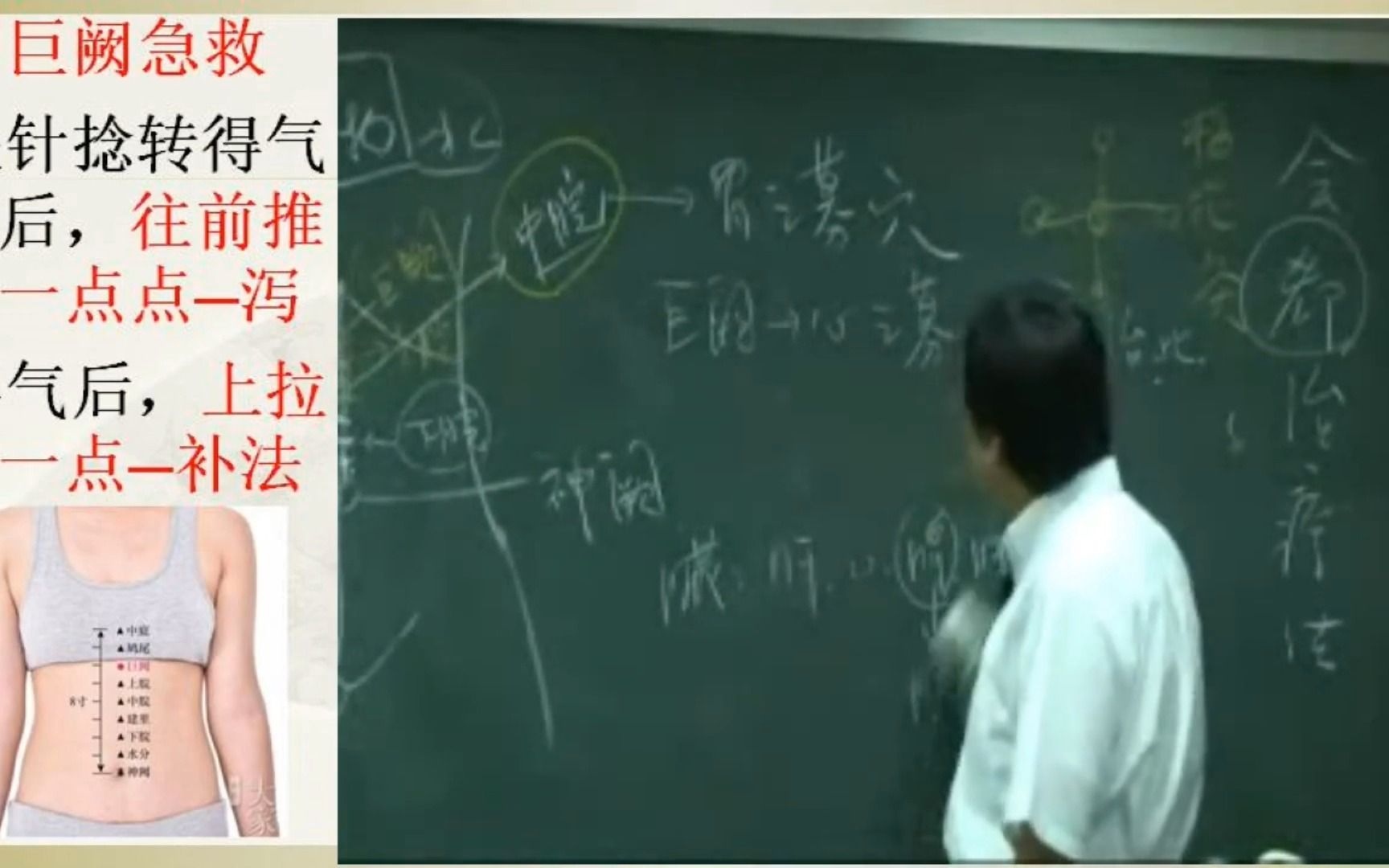 9 心梗血管堵塞急救,泻巨阙关元 倪海厦论针灸
