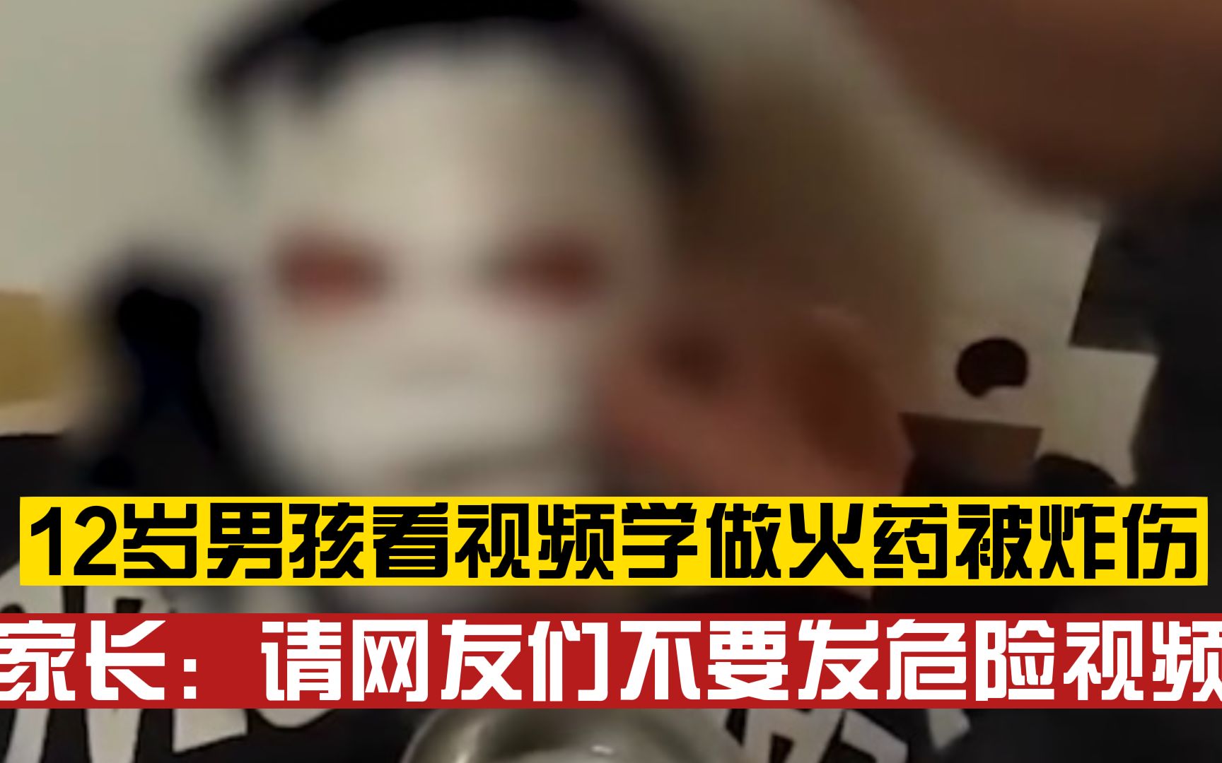 湖南一初中男孩看视频学做火药被炸伤,网友:家长应先承担看管责任