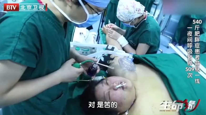 生命缘:男子体重高达540斤,数小时内呼吸停止500多次,命悬一线