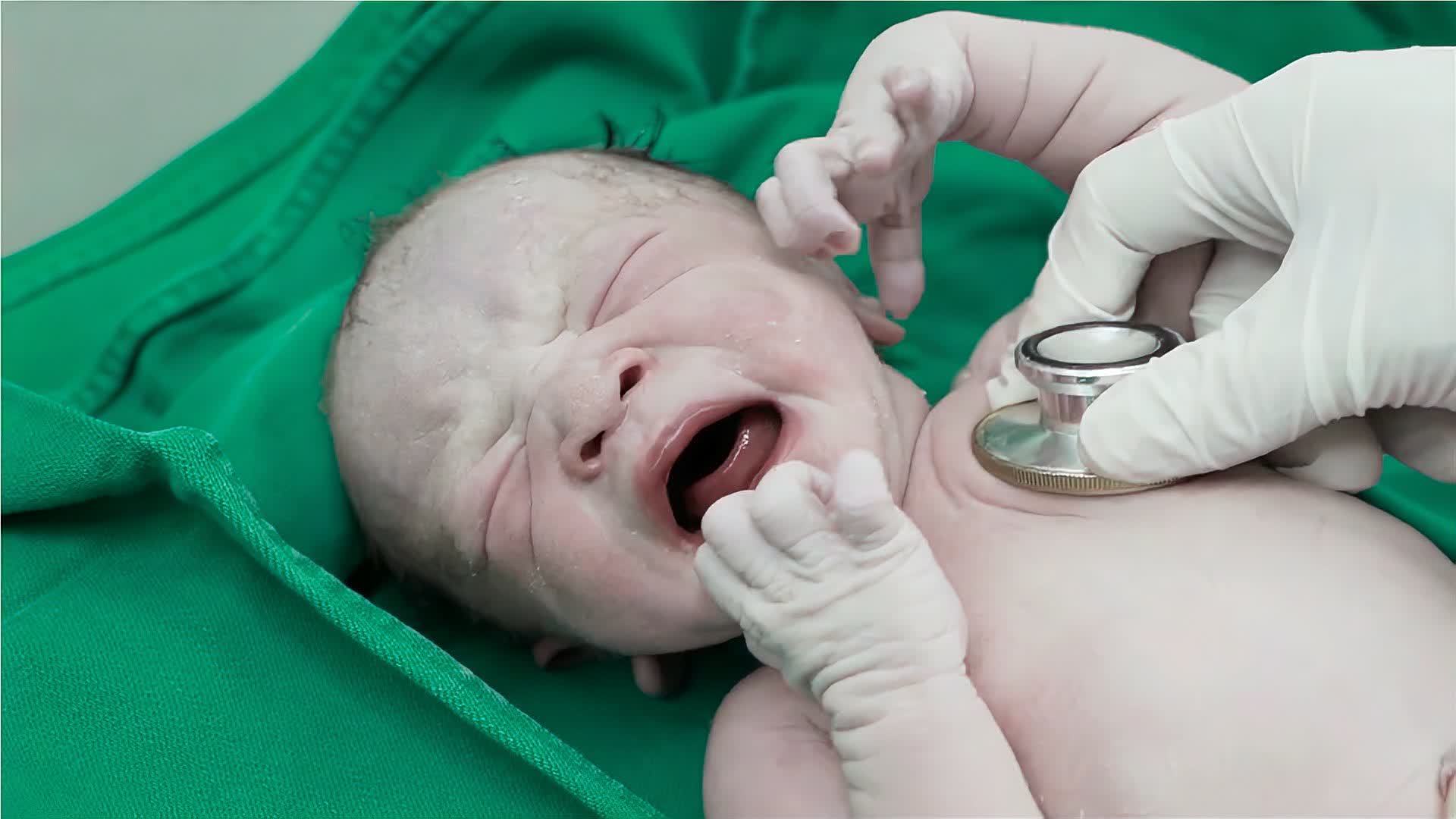 实拍:宝宝出生后最初的2分钟,到底经历了什么?