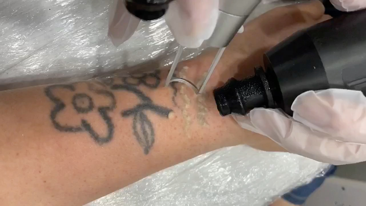 曾经有多少人好奇跟风,用针蘸着墨水在自己身上弄出自己觉得美翻了...