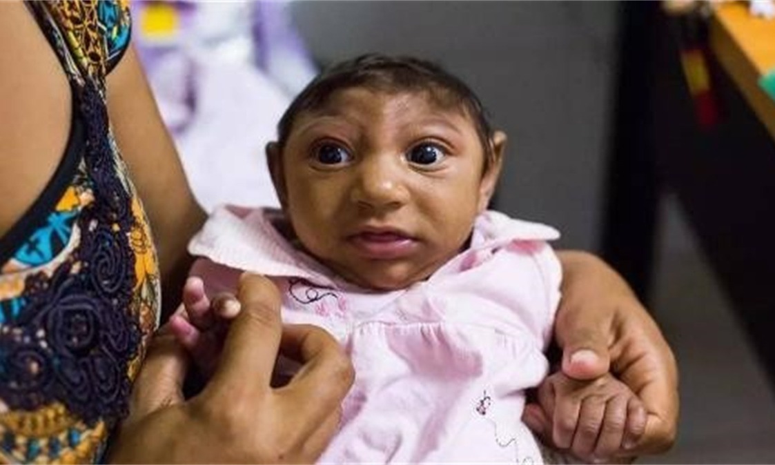 出生就没有脑袋怎么活?这个男婴被建议安乐死,两岁时奇迹发生了