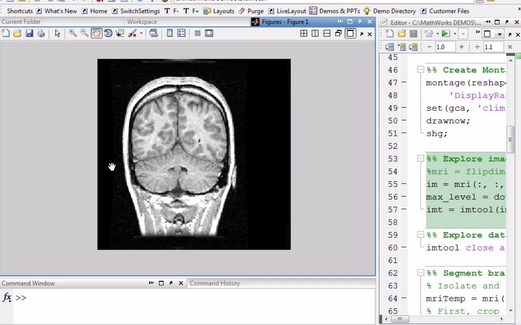 Medical Image Processing with MATLAB - MATLAB 在线研讨会 - ...