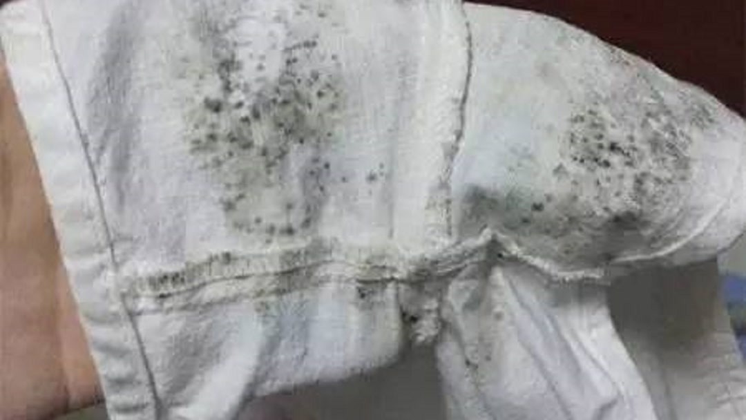 不管衣服发霉多严重,分享一个土方法,轻松洗掉,节省好几百元