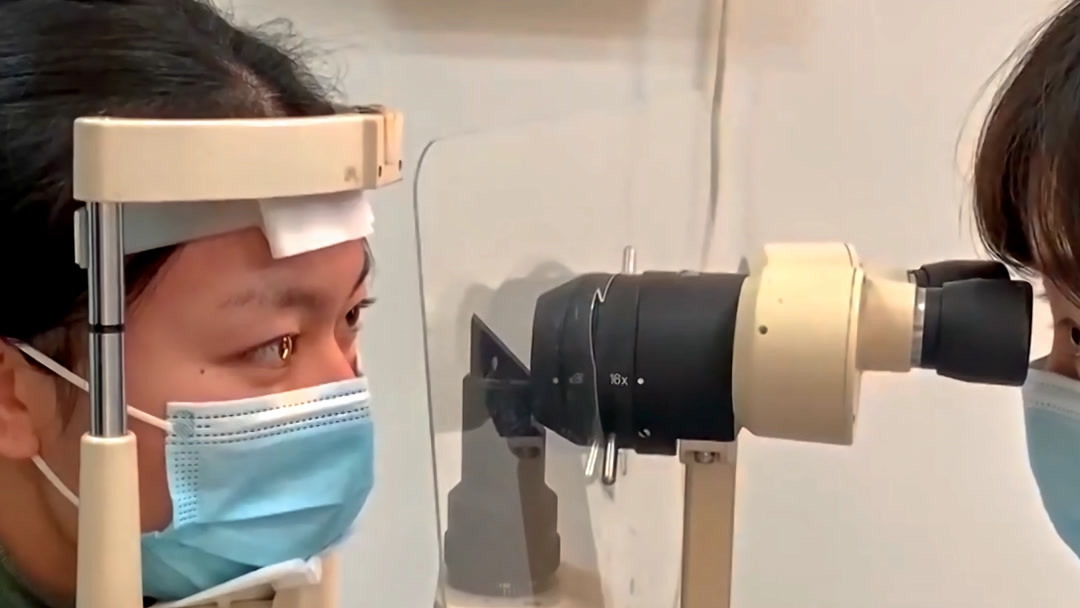 25岁女白领眼睛干痒,原因竟是睫毛里长了螨虫,要注意用眼健康