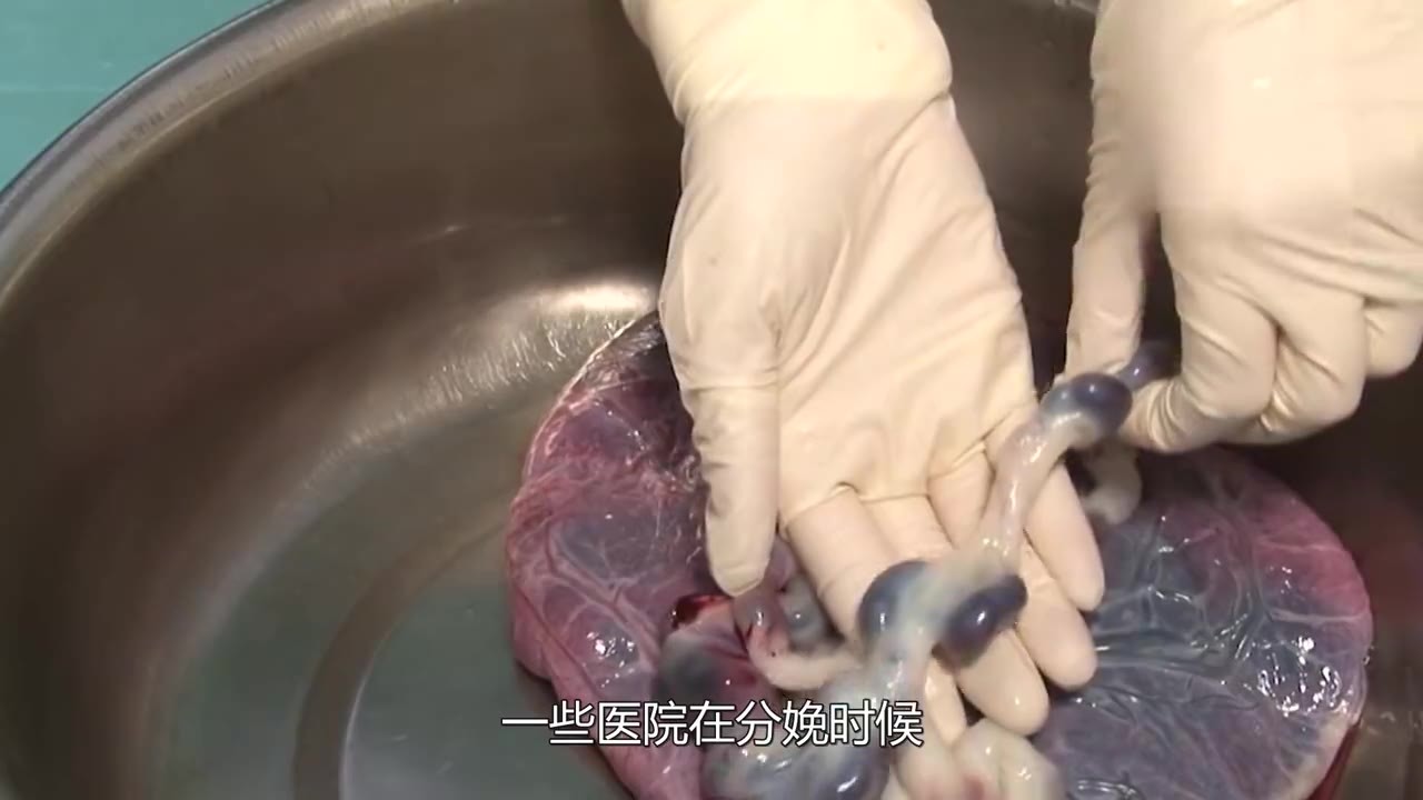 生完孩子的胎盘如何处理?不同人群不同用法,你的胎盘被吃了吗?