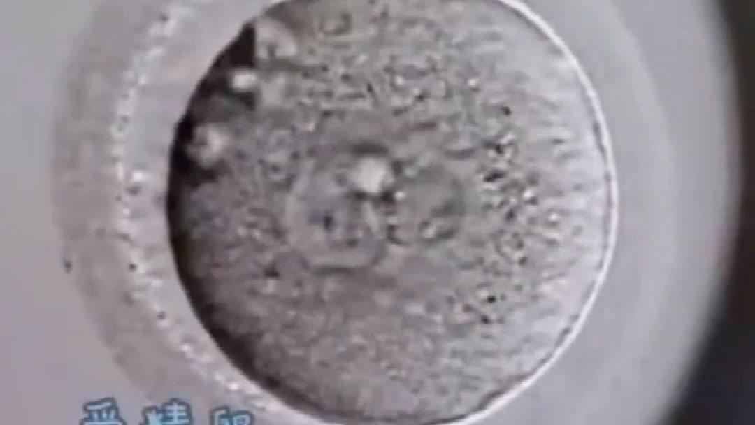 橄榄树生命——看受精卵发育成囊胚的过程,一个生命又要诞生了!