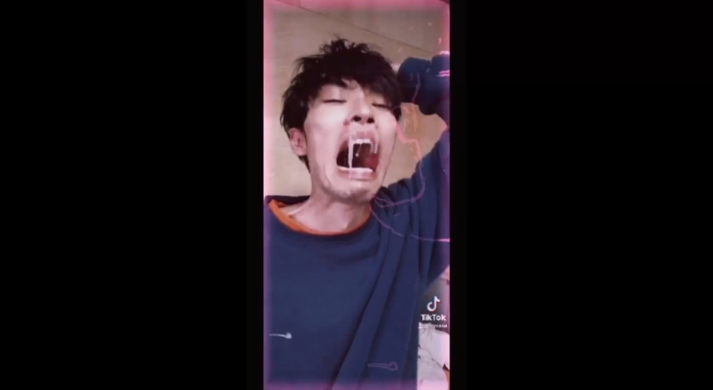 你们知道他为什么流鼻涕吗?