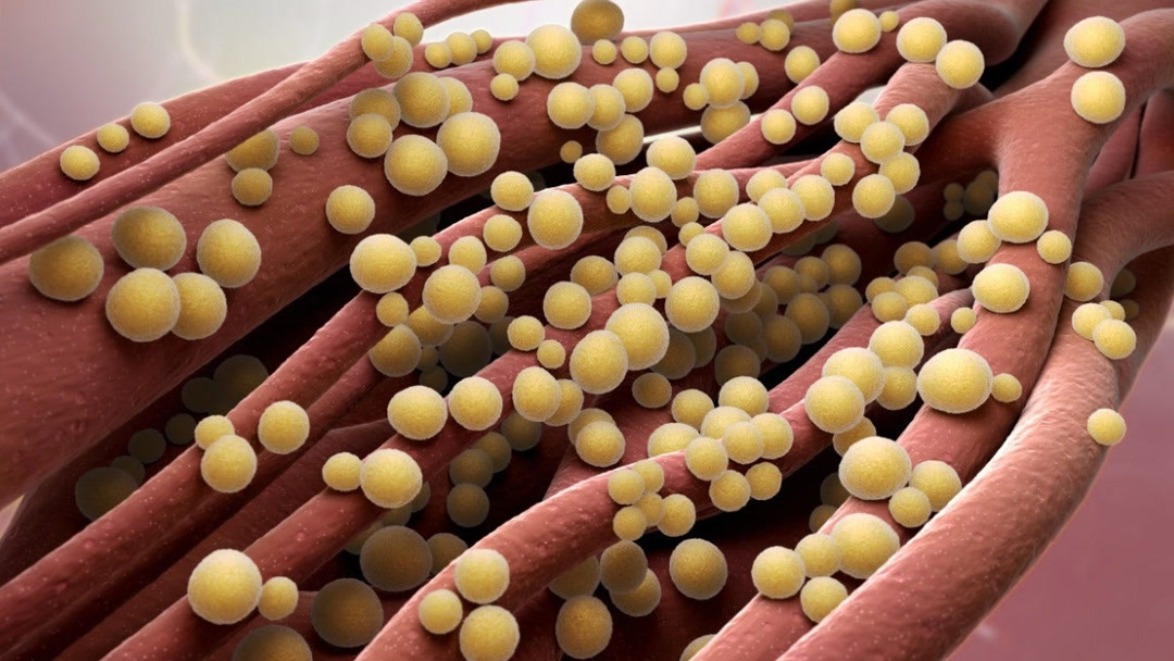 新冠肺炎患者治愈成功出院后,“自身”会留有后遗症吗?