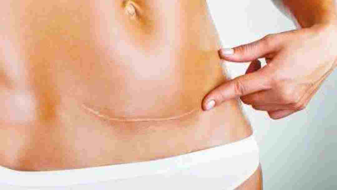 疤痕最好的治疗方法原来在这里?你还不知道吧!